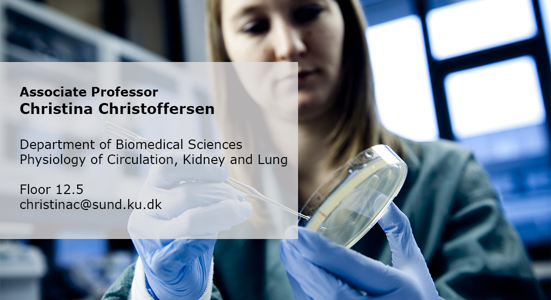 Christoffersen Group – University of Copenhagen