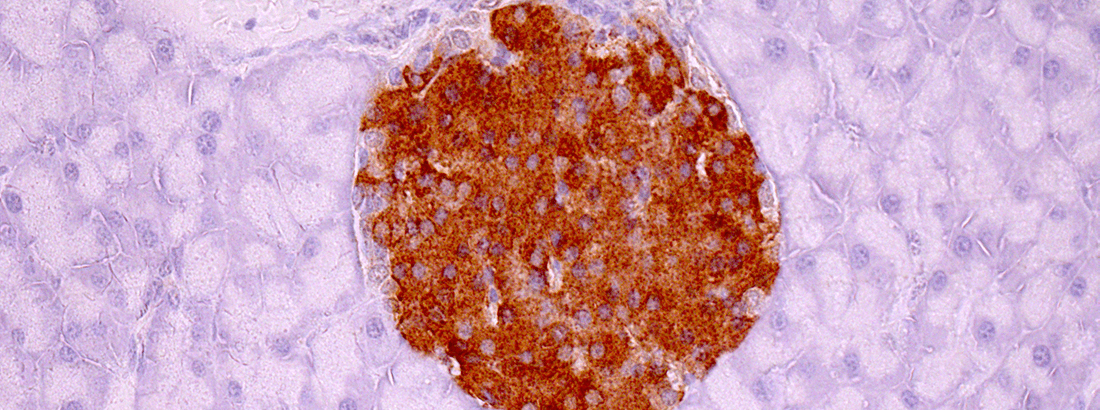 Mandrup-Poulsen Group – University of Copenhagen